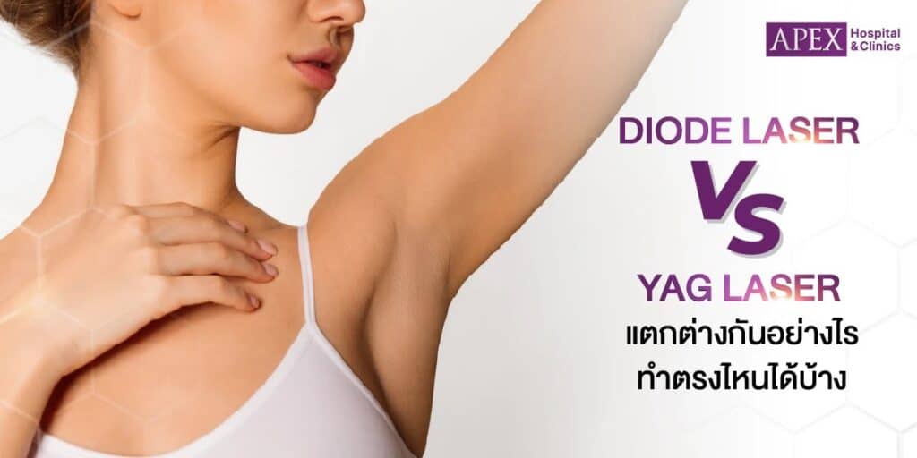 Diode laser VS YAG ต่างกันอย่างไร ประสิทธิภาพตัวไหนดีกว่า